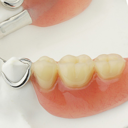 Pre-Prosthetics Surgery | Athens Oral Surgery Center | Denture Surgery